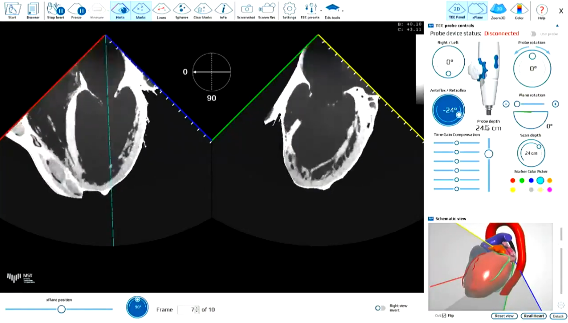 TEE Simulator recommended by professionals — Medical Simulation ...